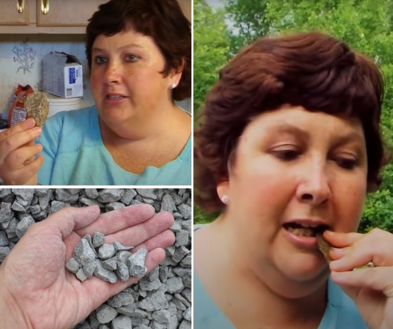 She has been eating stones every day for over 20 years